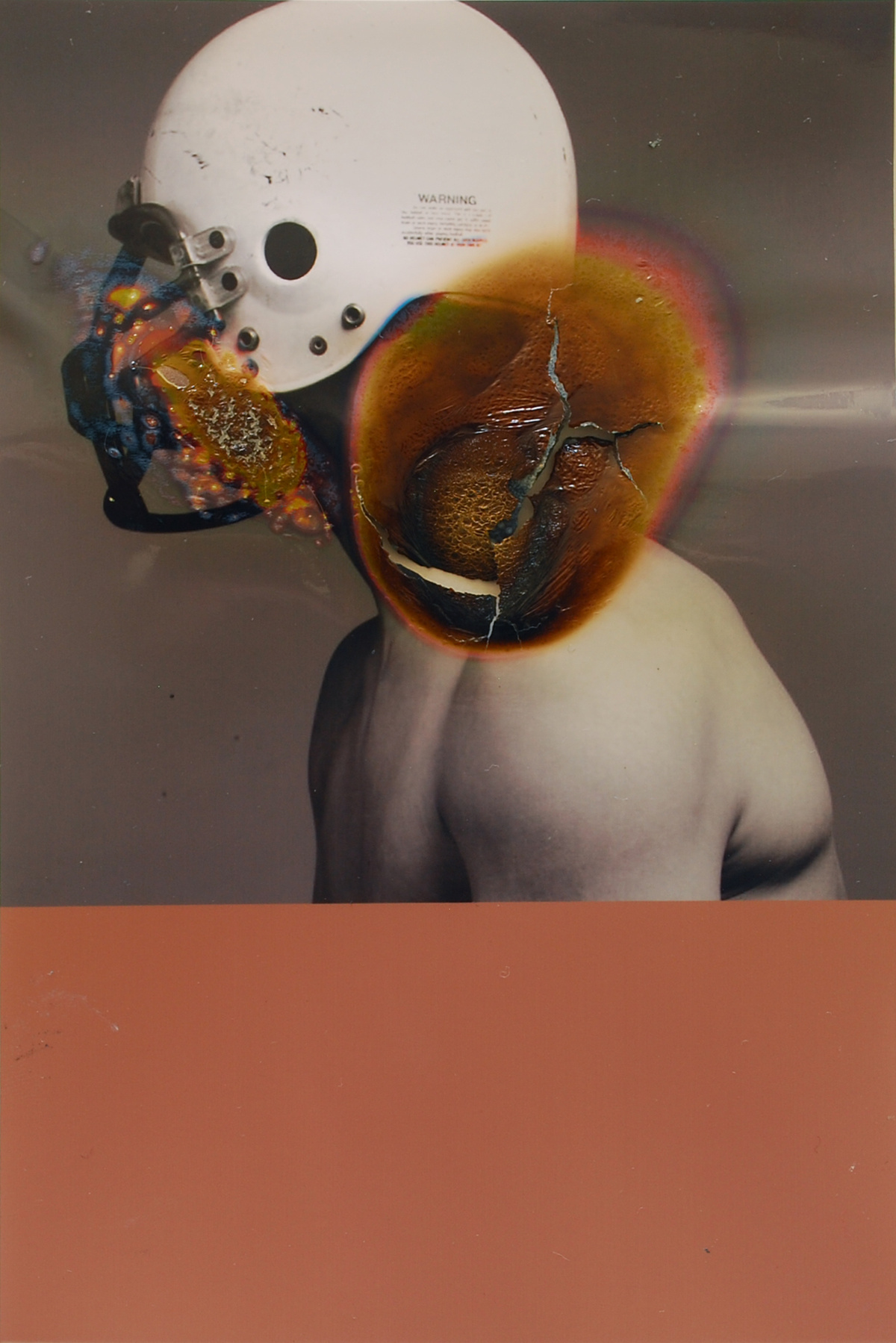 queimaduras — lucas simoes