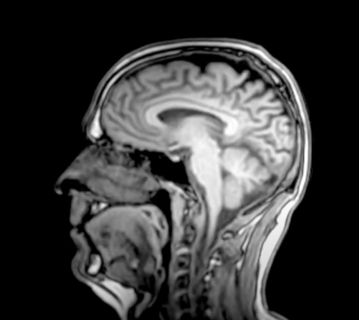 MRI PLAY KIT — Menex