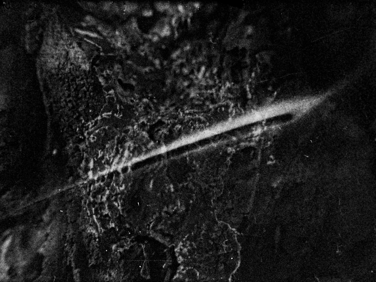 The wound edges — Yannick Mosimann