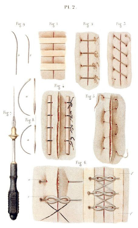 surgical stitching techniques — Entire Landscapes