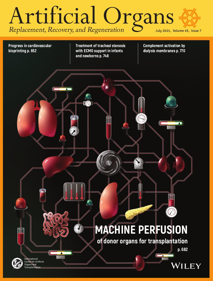 Machine Perfusion | Artificial Organs — Daniel Hertzberg Illustration Machine Perfusion | Artificial Organs — Daniel Hertzberg Illustration